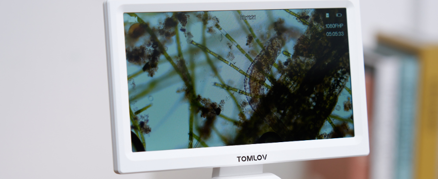 8 Tips for Viewing Bacteria Under a Digital Microscope